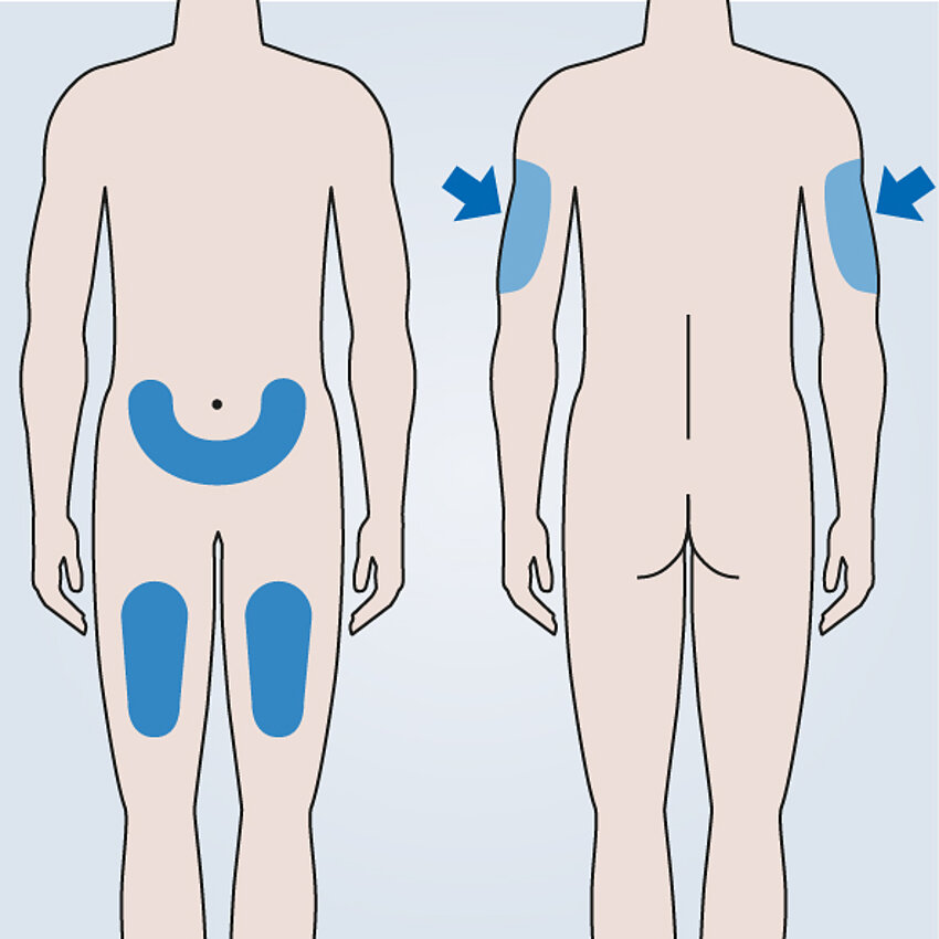 metoject® prefilled syringe